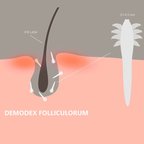Condiciones o Enfermedades de los Ojos Frecuentes