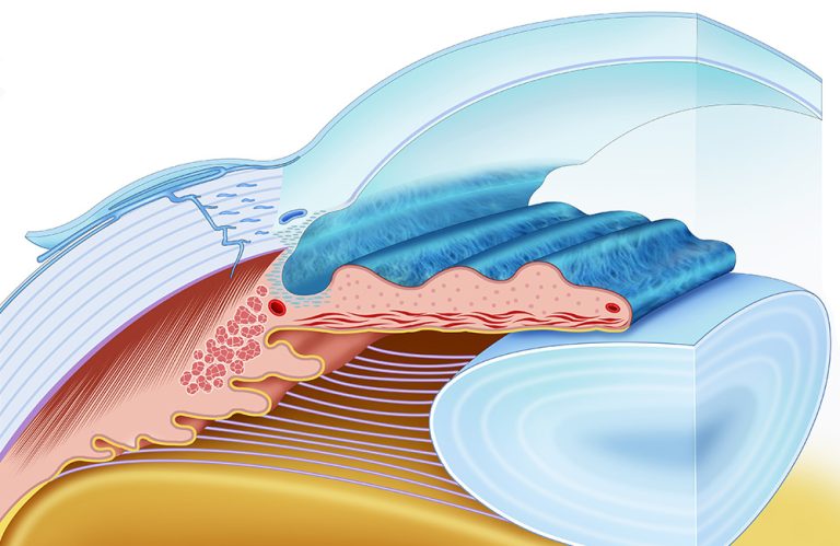 Tratamiento de Córnea y Segmento Anterior en Ibagué, Tolima